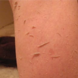 Baiden Mitten - The Best Skin Exfoliator For All Skin Types