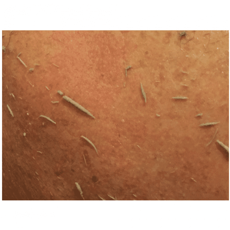 Baiden Mitten Exfoliator System 2023 - Baiden Mitten