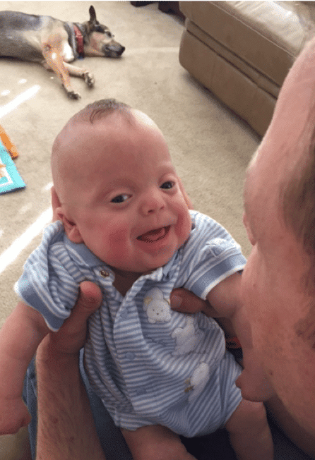 Dx Intraventricular Hemorrhage & Tetrasomy 12p: Austin's Success Story ...