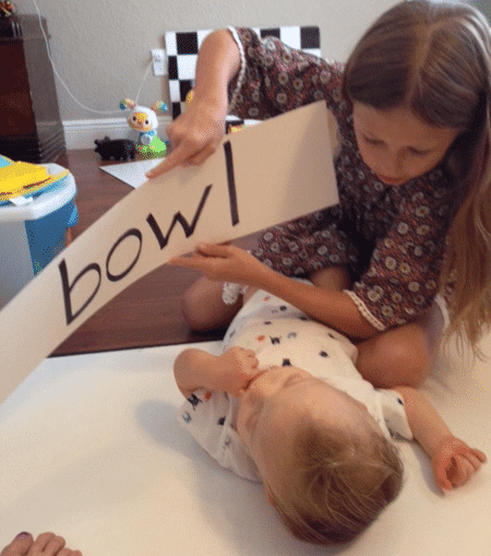 Dx Intraventricular Hemorrhage & Tetrasomy 12p: Austin's Success Story ...