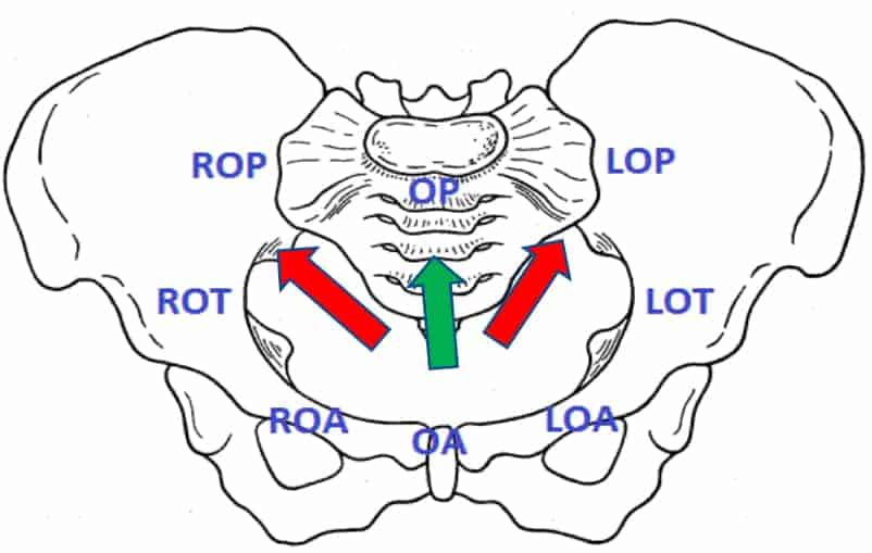 Occiput-Posterior Position (OP) - www.medicoapps.org