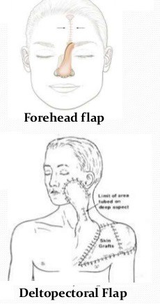 FLAPS - www.medicoapps.org