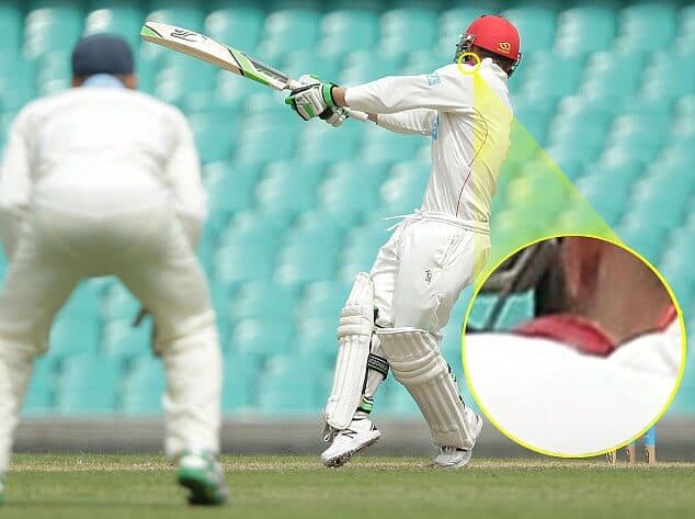 Remembering Phil Hughes – A Ball He Should Have Ducked ⋆ Sportycious