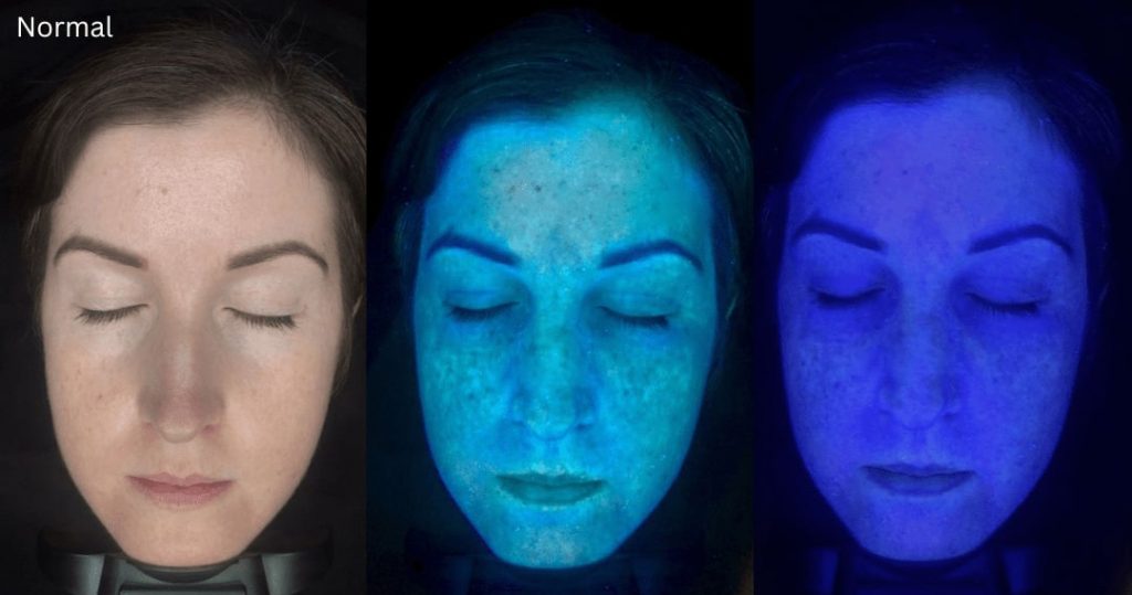 New Addition - OBSERV Device - Dr Tanja Phillips Clinic